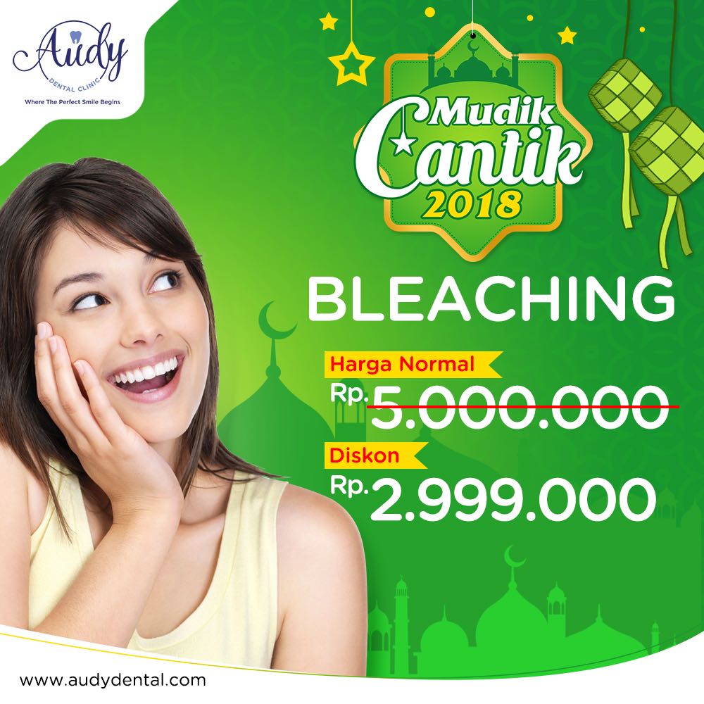 Promo Pasang Behel, Veneer, Bleaching, Scaling | Audy Dental