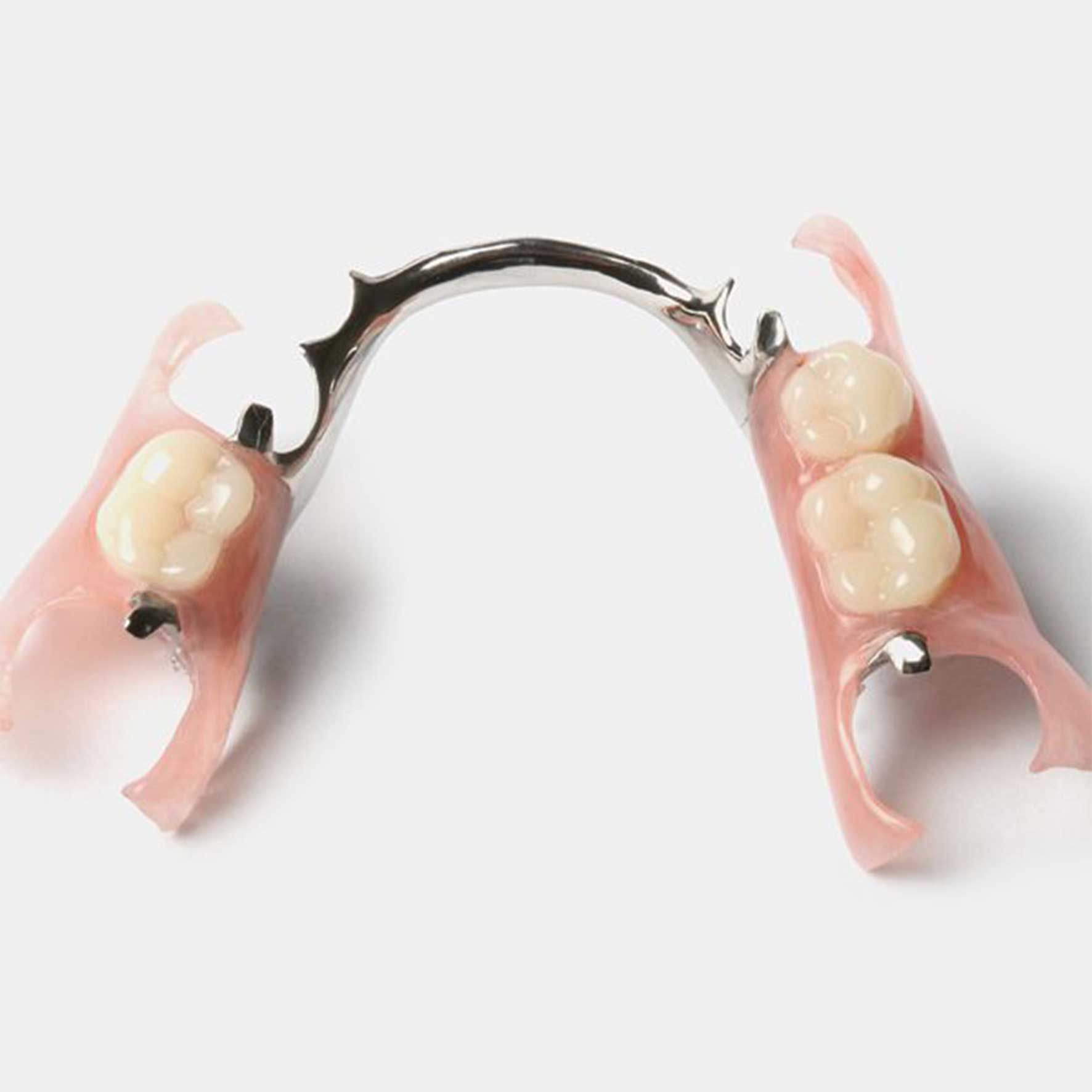 gigi-tiruan-palsu-frame-metal | Audy Dental